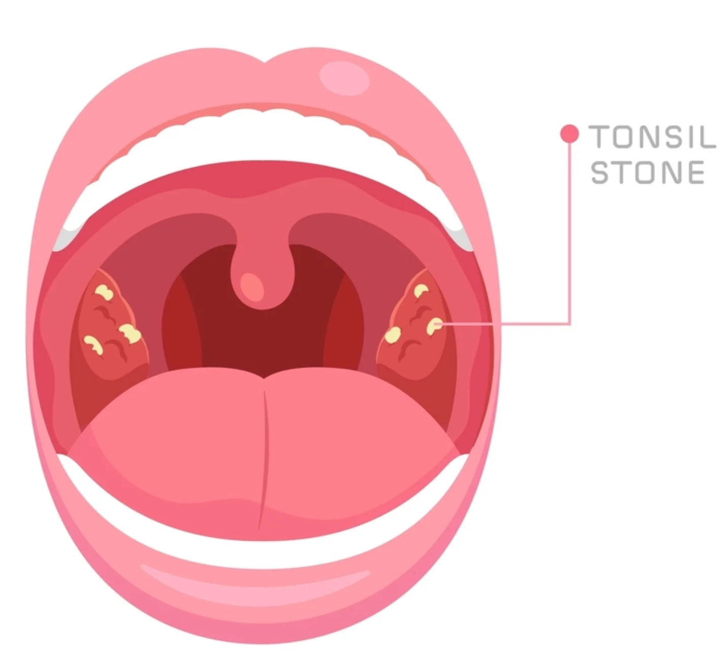 Oil Pulling Guide: Benefits, Methods, Oils & Remedies